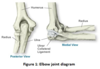 Elbow Surgery | NRAS and information on Elbow Surgery